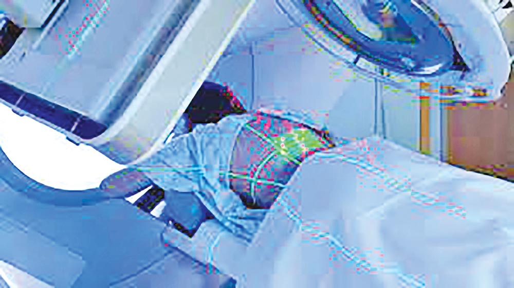Radiation therapy: A powerful weapon in the fight against cancer